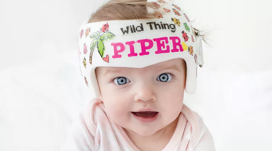Doc Band® Treatment for Plagiocephaly | Cranial Technologies