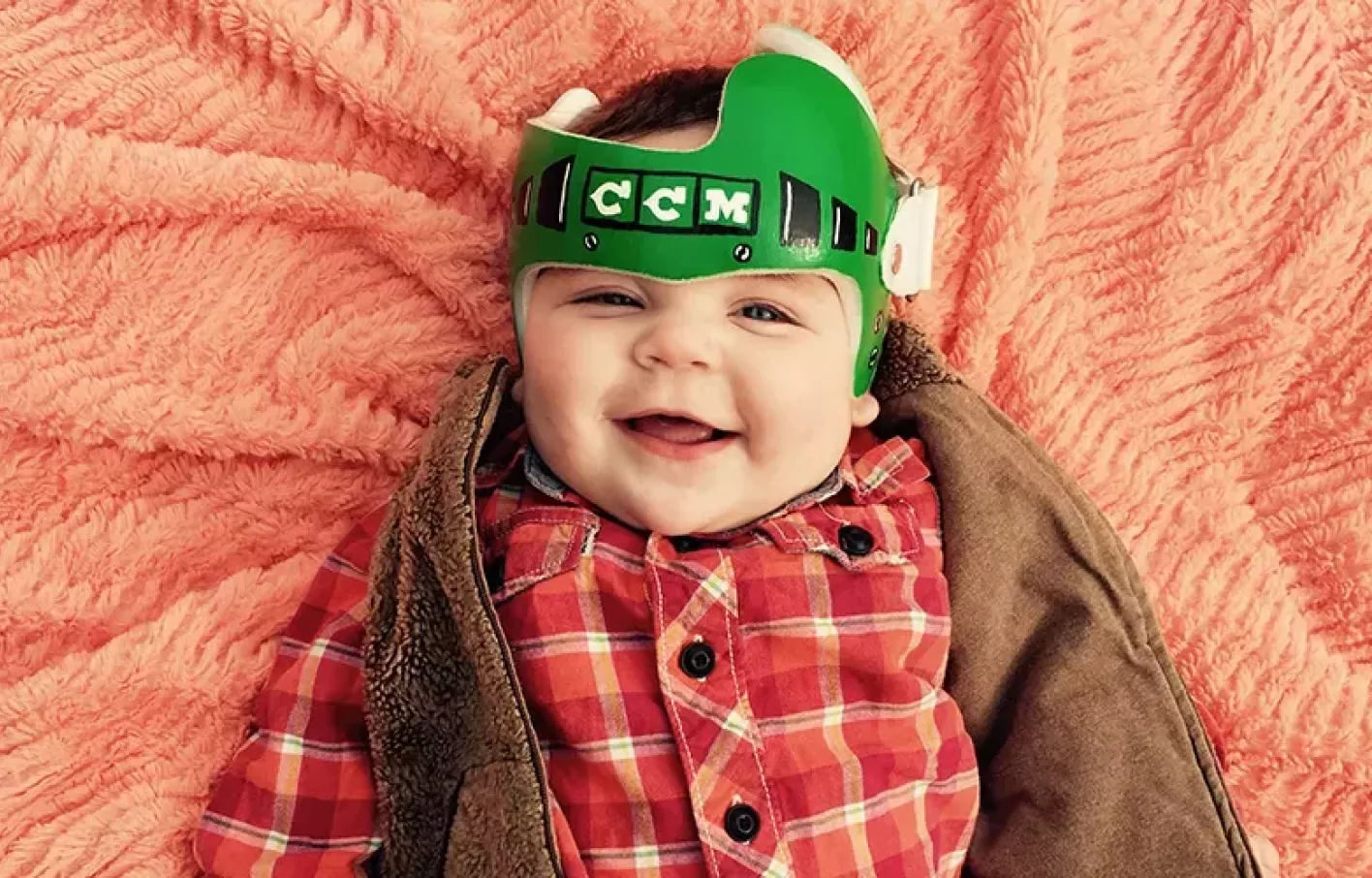 Doc Band® Treatment for Plagiocephaly | Cranial Technologies