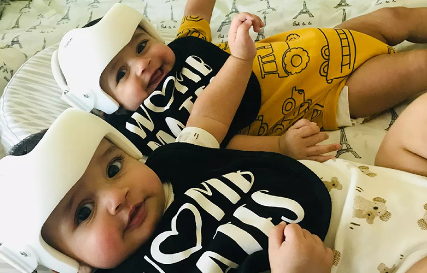 Doc Band® Treatment for Plagiocephaly | Cranial Technologies